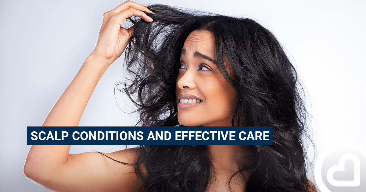 Understanding scalp conditions and effective care – – Familiprix