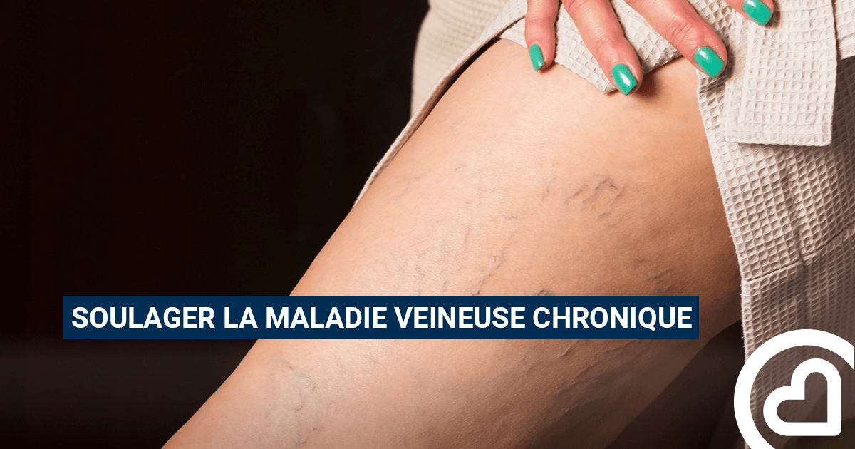 Soulager la maladie veineuse chronique – Familiprix